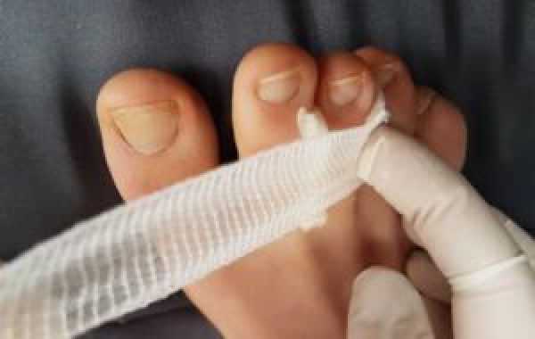 Bandaging Toes – First Aid Wound Care