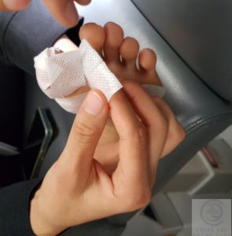 Ballerina Feet – First Aid Wound Care